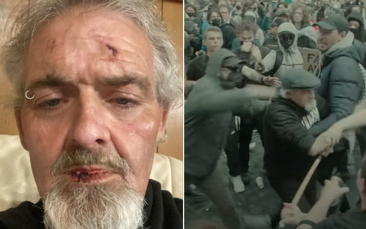 Patriot left with severe injuries from leftist attack