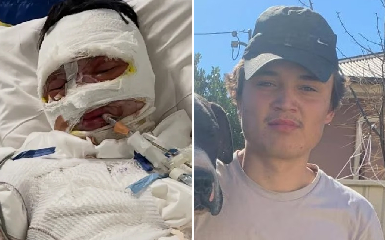 Teen allegedly set on fire by aboriginal in NSW country town